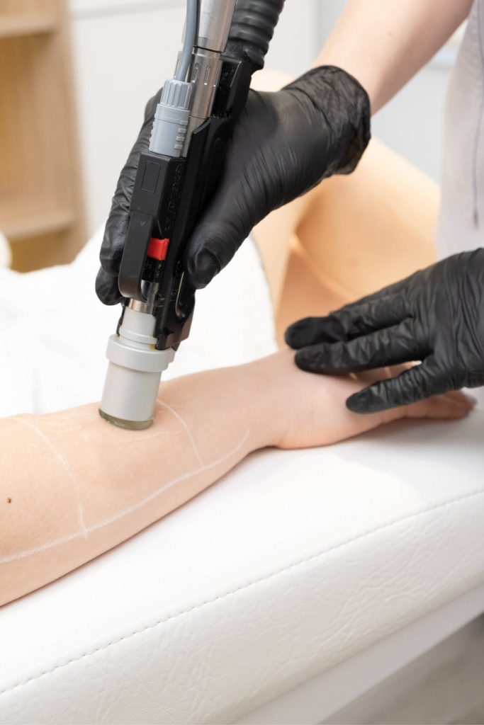 DEKA Moveo – epilare definită – BeautySpace